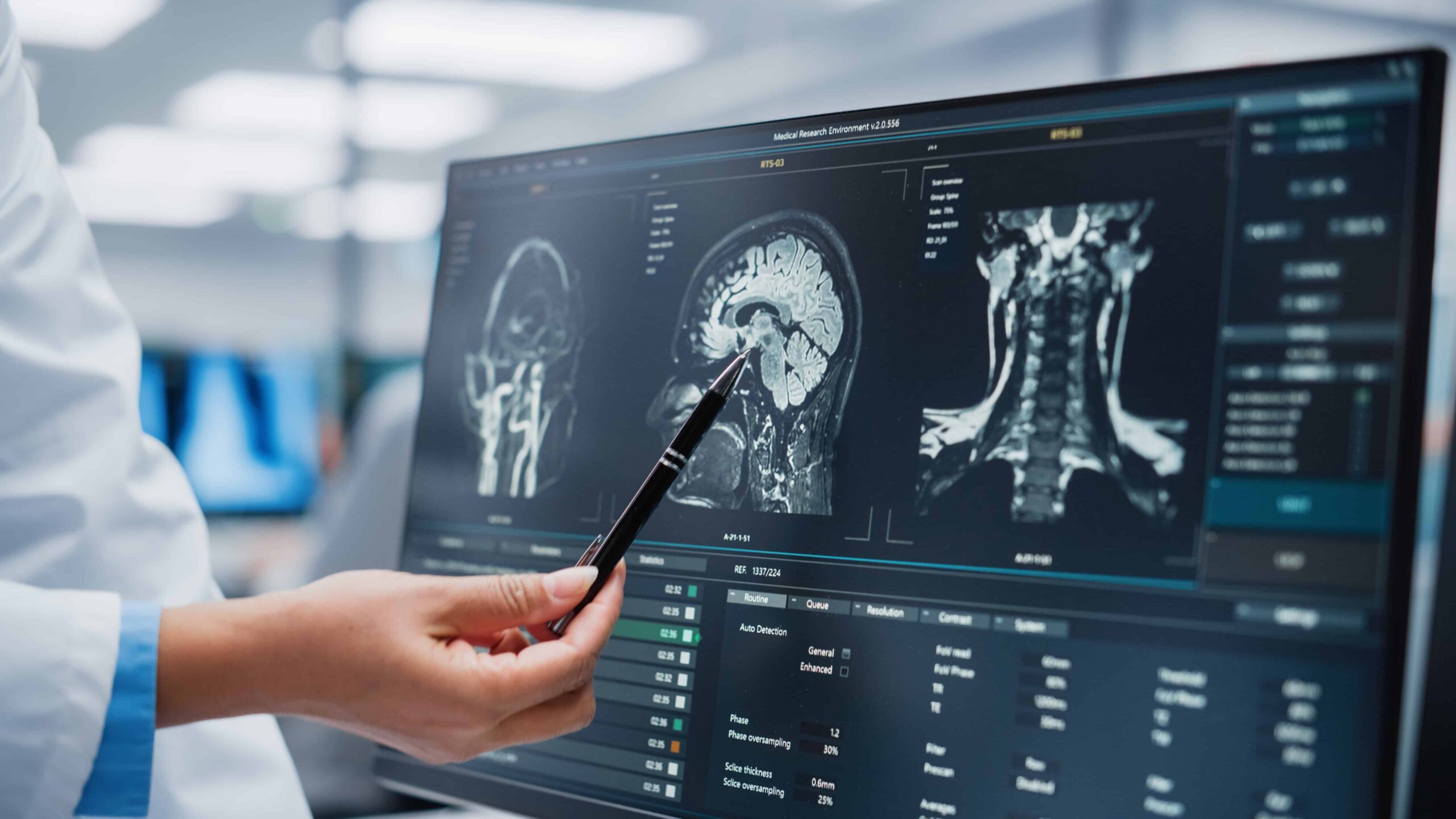 Palm Bay Brain Injury Attorneys